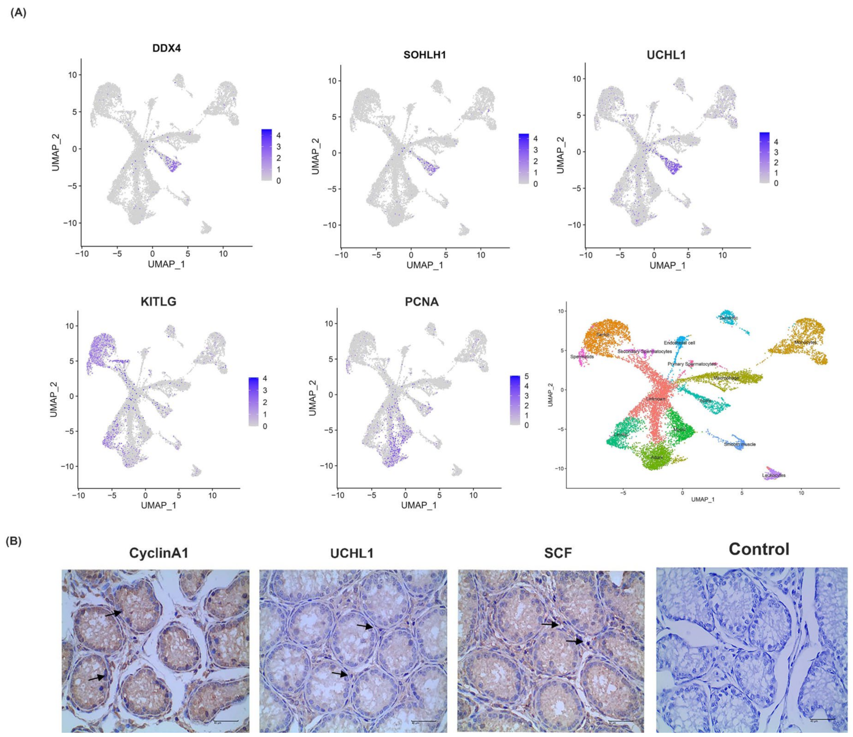 Cimb Free Full Text The Transcriptional Cell Atlas Of Testis