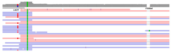 Personalized Selection of a CFTR Modulator for a Patient with a Complex ...