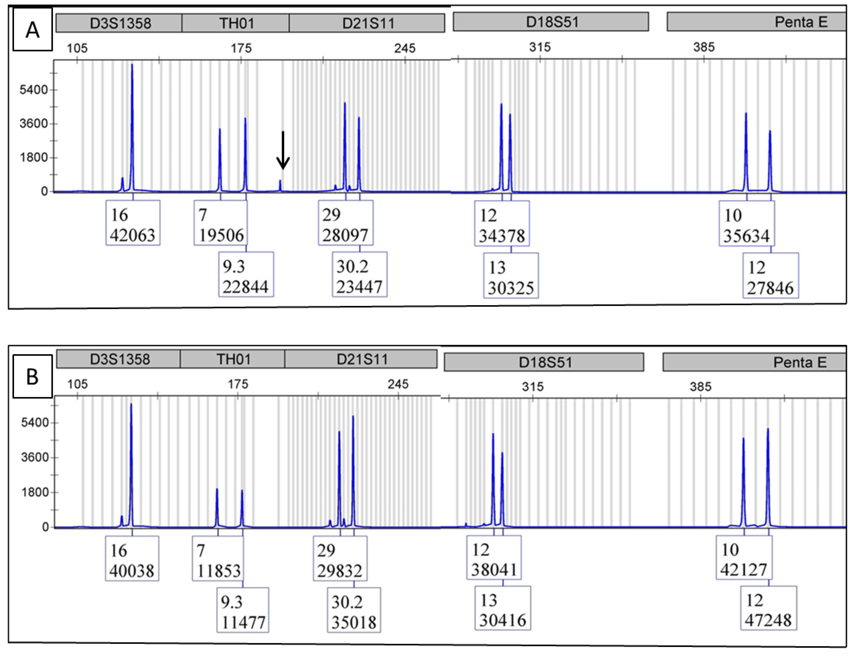 Dna Profiling Dna Profiling
