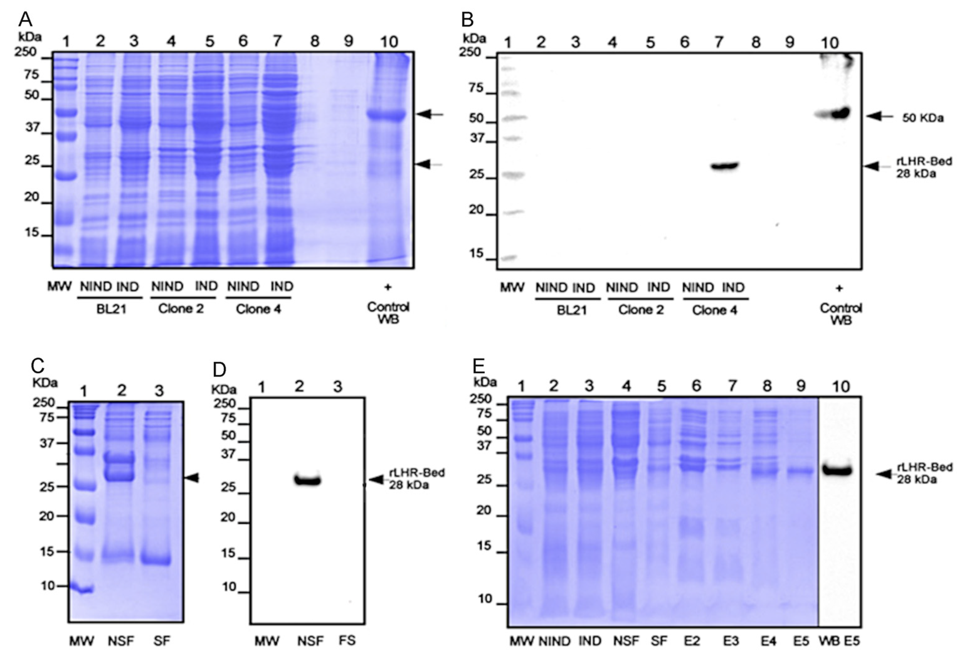 Single-Step Protocol for Isolating the Recombinant Extracellular Domain ...