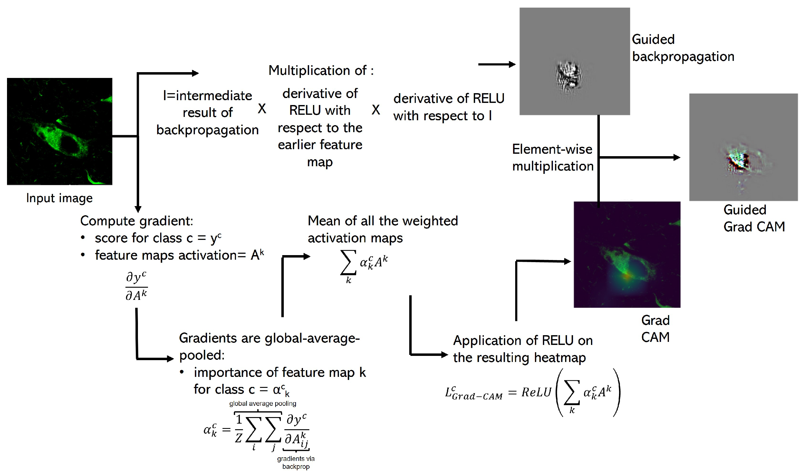 Interpretable Classification of Tauopathies with a Convolutional Neural ...