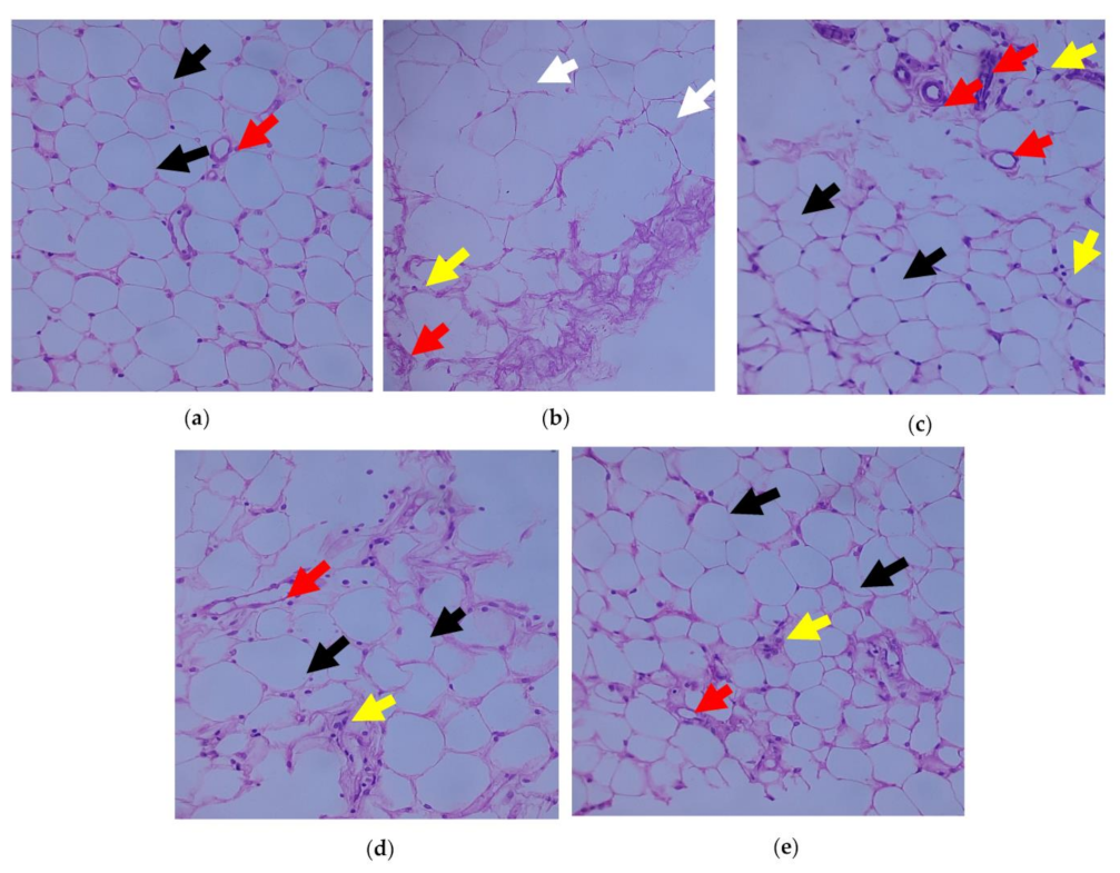 Carica Papaya Reduces High Fat Diet and Streptozotocin-Induced ...