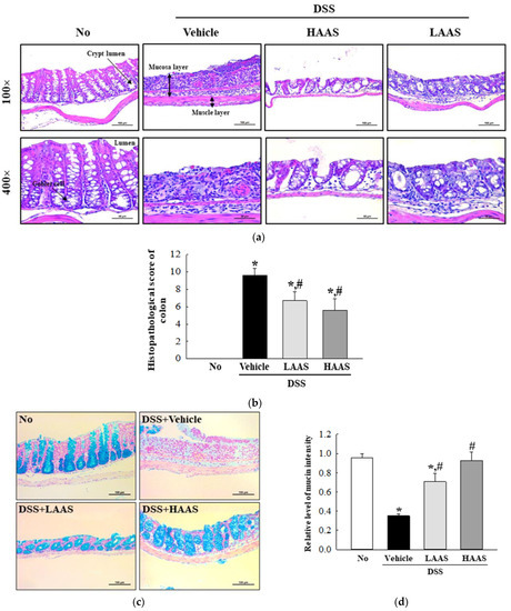 Therapeutic Effects of Aloe saponaria against Ulcerative Colitis ...