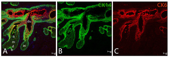 Ductal Hyperkeratinization and Acinar Renewal Abnormality: New Concepts ...