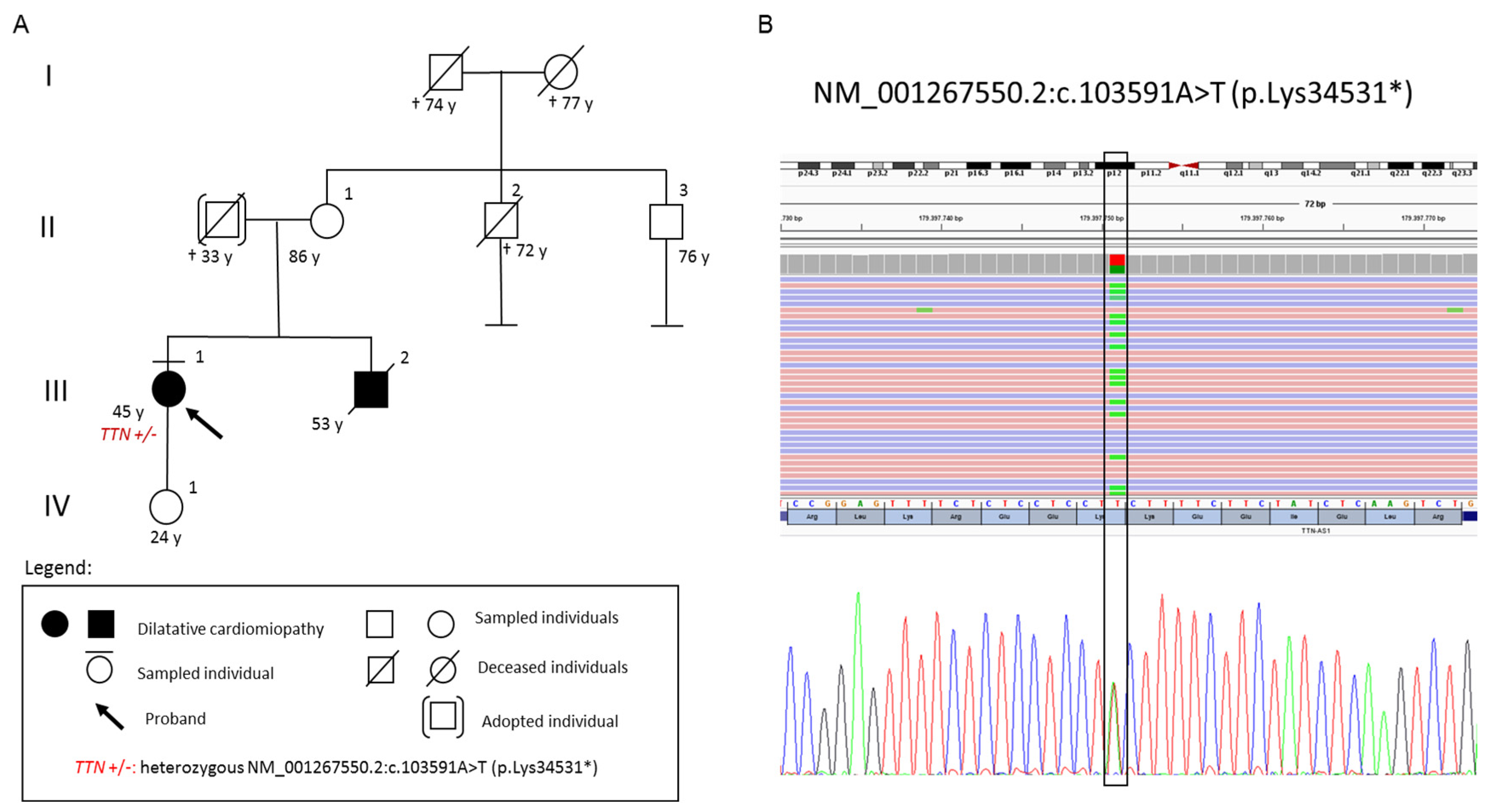 CIMB | Free Full-Text | A Novel Nonsense Pathogenic TTN Variant ... CIMB | Free Full-Text | A Novel Nonsense Pathogenic TTN Variant ...
