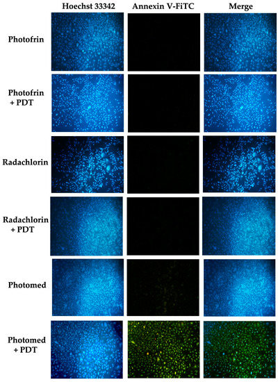 The In Vitro and In Vivo Anticancer Effect of Photomed for Photodynamic ...