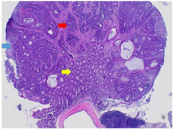 Specific Targeting and Labeling of Colonic Polyps in CPC-APC Mice with ...