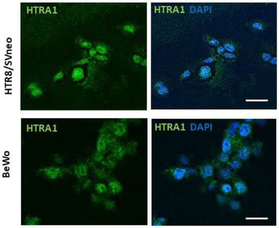 HTRA1 in Placental Cell Models: A Possible Role in Preeclampsia