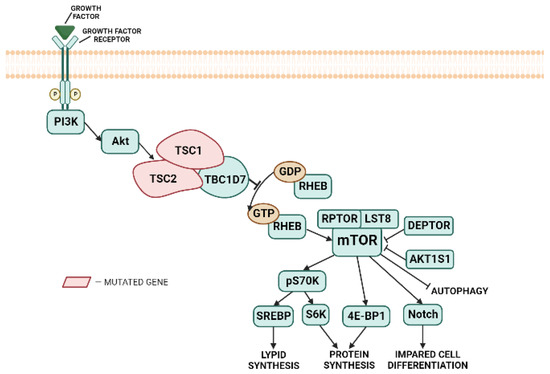 Specific Features of Focal Cortical Dysplasia in Tuberous Sclerosis Complex