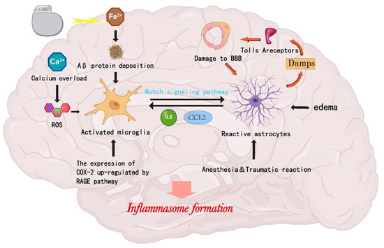 CIMB | Free Full-Text | Insights into Advanced Neurological Dysfunction ...