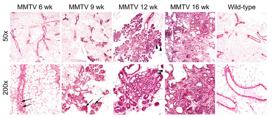 Characterization of Mammary Tumors Arising from MMTV-PyVT Transgenic Mice