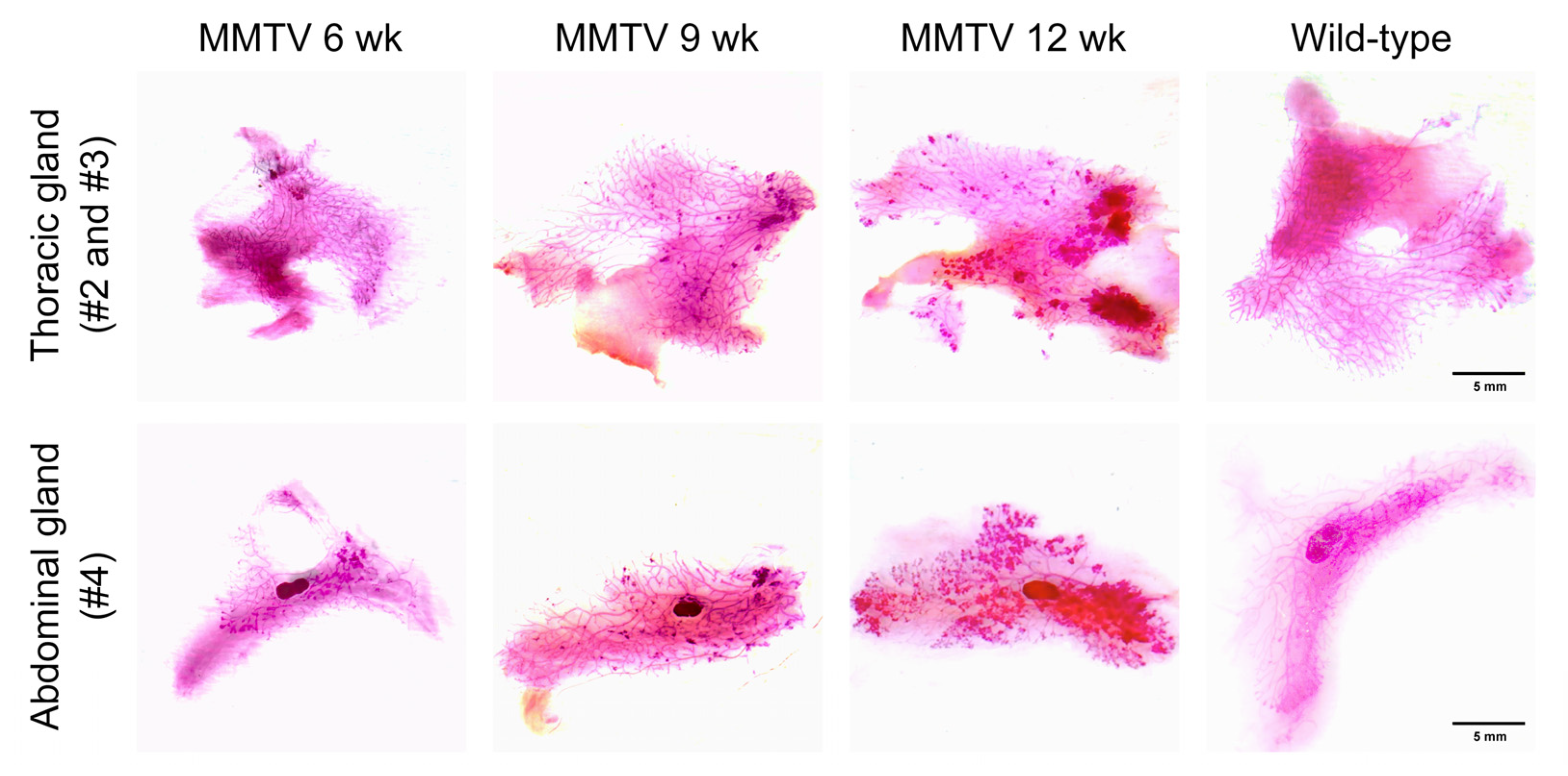 Characterization of Mammary Tumors Arising from MMTV-PyVT Transgenic Mice