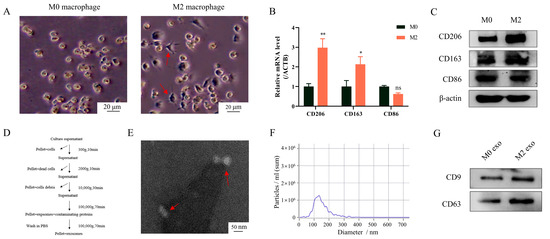 CIMB | Free Full-Text | M2 Macrophages-Derived Exosomal miRNA-23a-3p ...