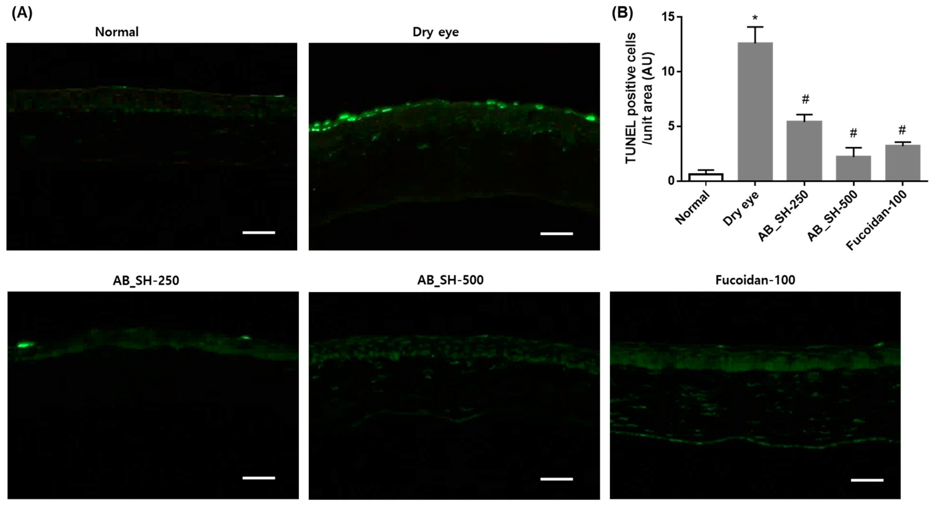 The Effects of Sargassum horneri Extract and Fucoidan on Tear ...