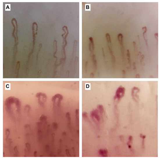 Biomarkers in Systemic Sclerosis: An Overview