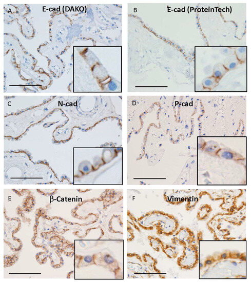 E-Cadherin Is Expressed in Epithelial Cells of the Choroid Plexus in ...