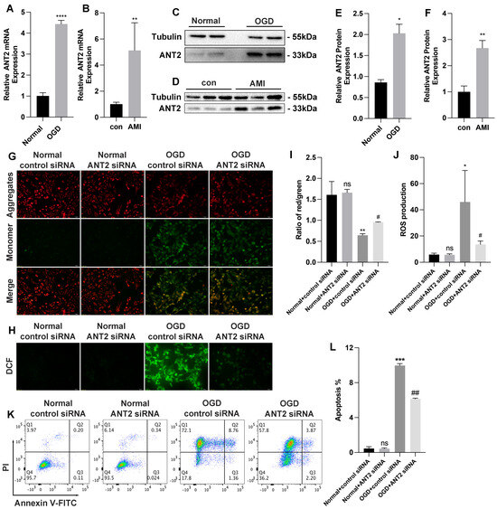 Implications of Activating the ANT2/mTOR/PGC-1α Feedback Loop: Insights ...