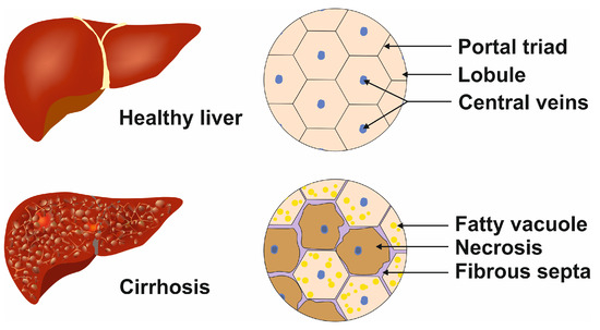Recent Advances in Liver Tissue Engineering as an Alternative and ...