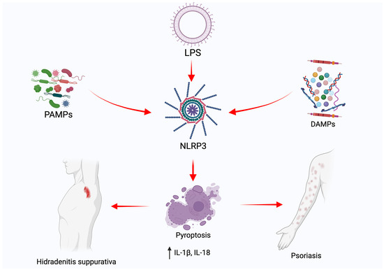 Pathological and Therapeutical Implications of Pyroptosis in Psoriasis ...