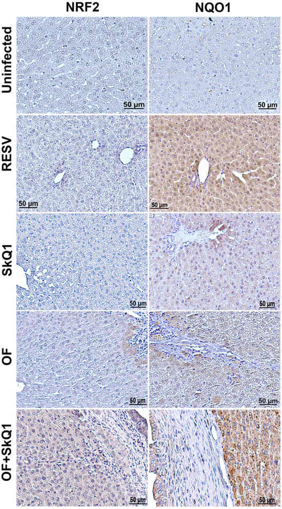 CIMB | Free Full-Text | Plastoquinone-Derivative SkQ1 Improved the ...