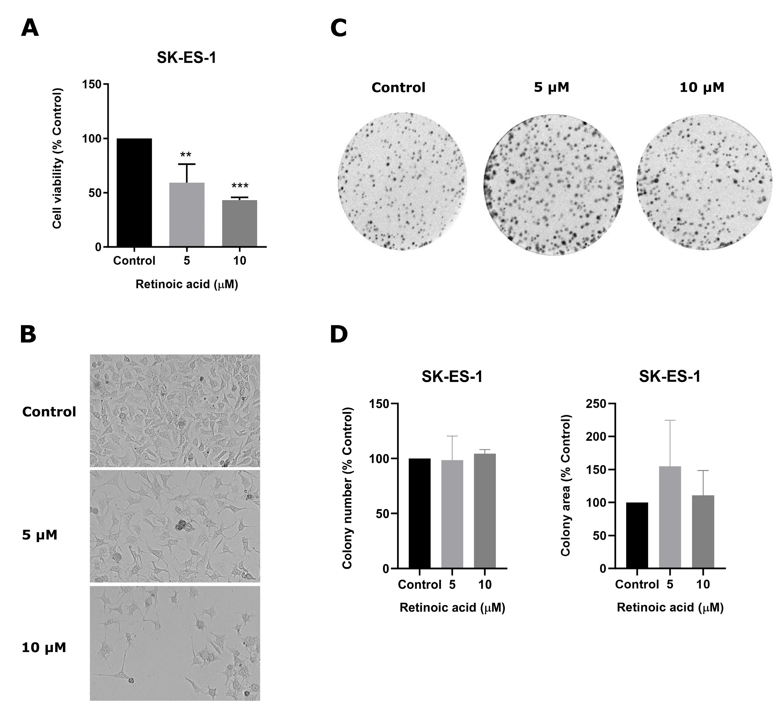 Stemness and Cell Cycle Regulators and Their Modulation by Retinoic Acid in Ewing Sarcoma