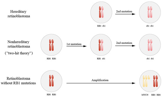 Molecular Biological Research on the Pathogenic Mechanism of Retinoblastoma