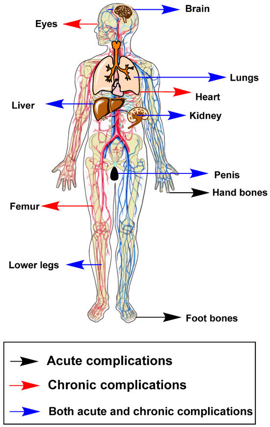 Sickle Cell Disease: Current Drug Treatments and Functional Foods with ...