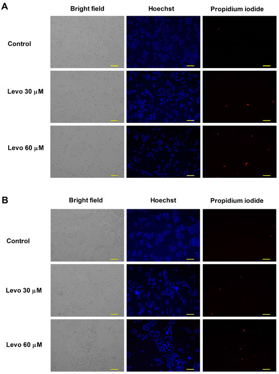 An In Vitro Investigation of the Antiproliferative and Antimetastatic ...