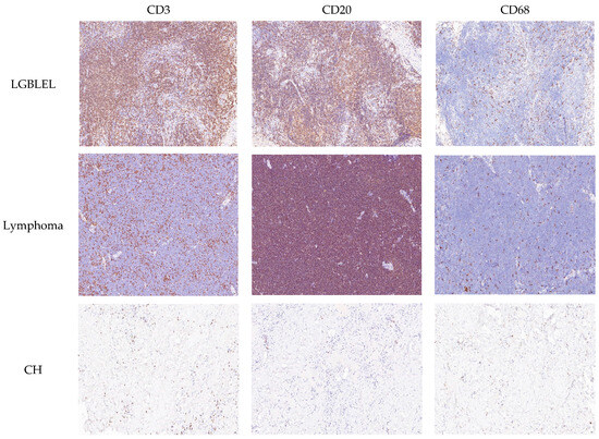 Loss of CCL28 and CXCL17 Expression and Increase in CCR1 Expression May ...
