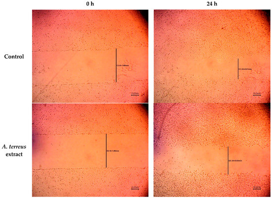 Wound Healing, Metabolite Profiling, and In Silico Studies of ...