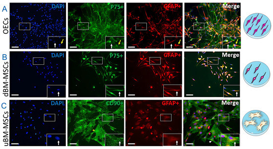 GFAPβ and GFAPδ Isoforms Expression in Mesenchymal Stem Cells, MSCs ...