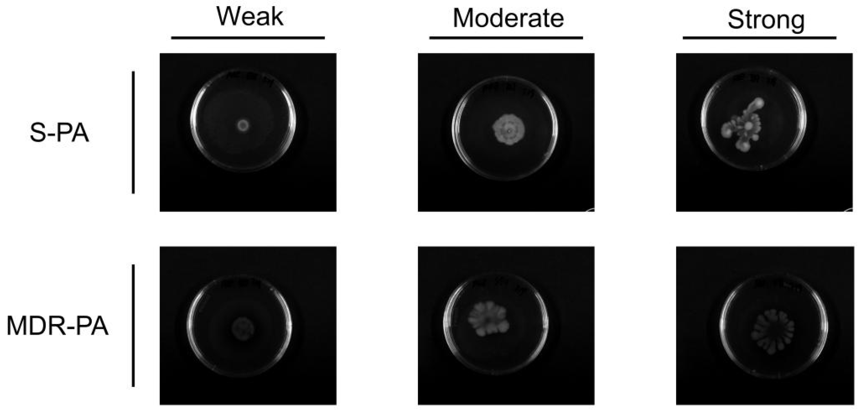 Correlation Analysis Between Multi-Drug Resistance Phenotype and ...