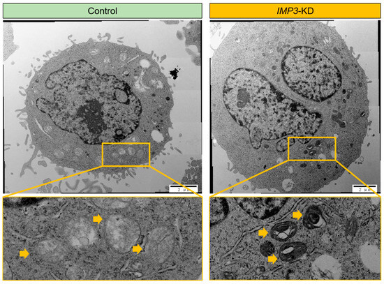 Regulation of Energy Metabolism and Lipid Metabolites by IMP3 in ...