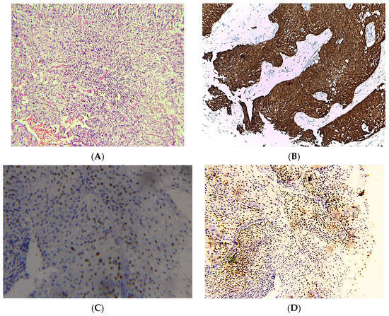 Clinics and Practice | Free Full-Text | Clinico-Pathological Features ...