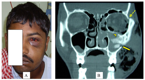 Camel-Related Facial Injuries: A Seven-Year Retrospective Study
