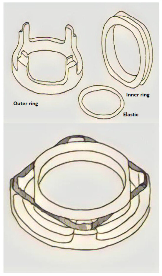 Phimosis in Adults: Narrative Review of the New Available Devices and ...