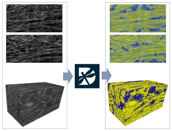 Case Report of a Dental Implant with Conometric Abutment–Prosthetic Cap ...