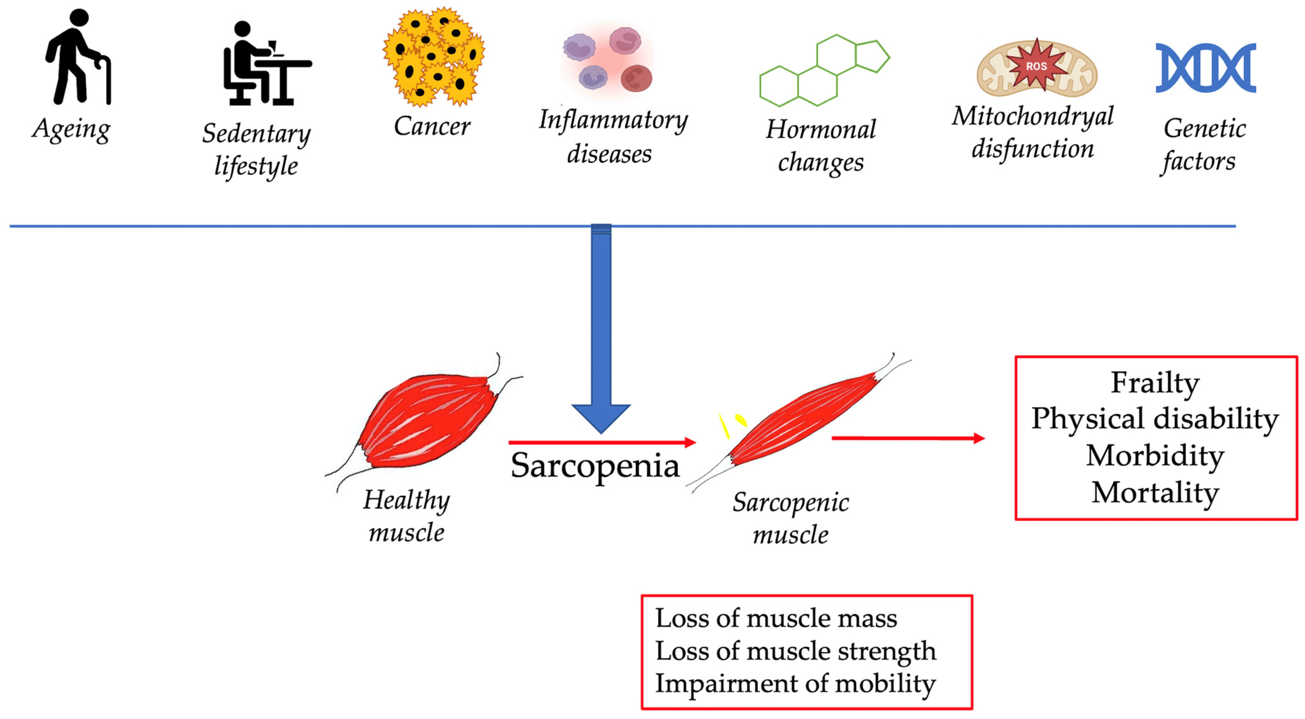 Dietary Protein and Physical Exercise for the Treatment of Sarcopenia
