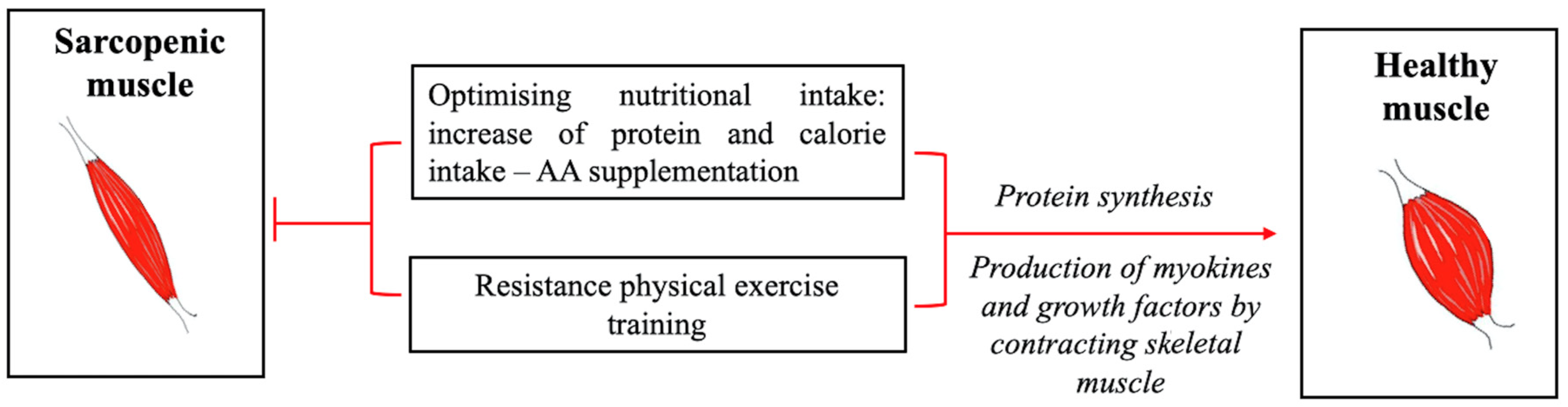 Dietary Protein and Physical Exercise for the Treatment of Sarcopenia