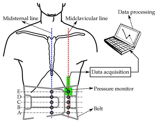 A Safety-Centric Study on the Use of Inflatable Abdominal Binders for ...