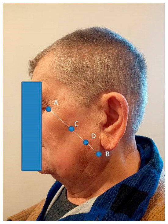 Dentures Used for Rehabilitation of Mastication After Loss of Teeth ...