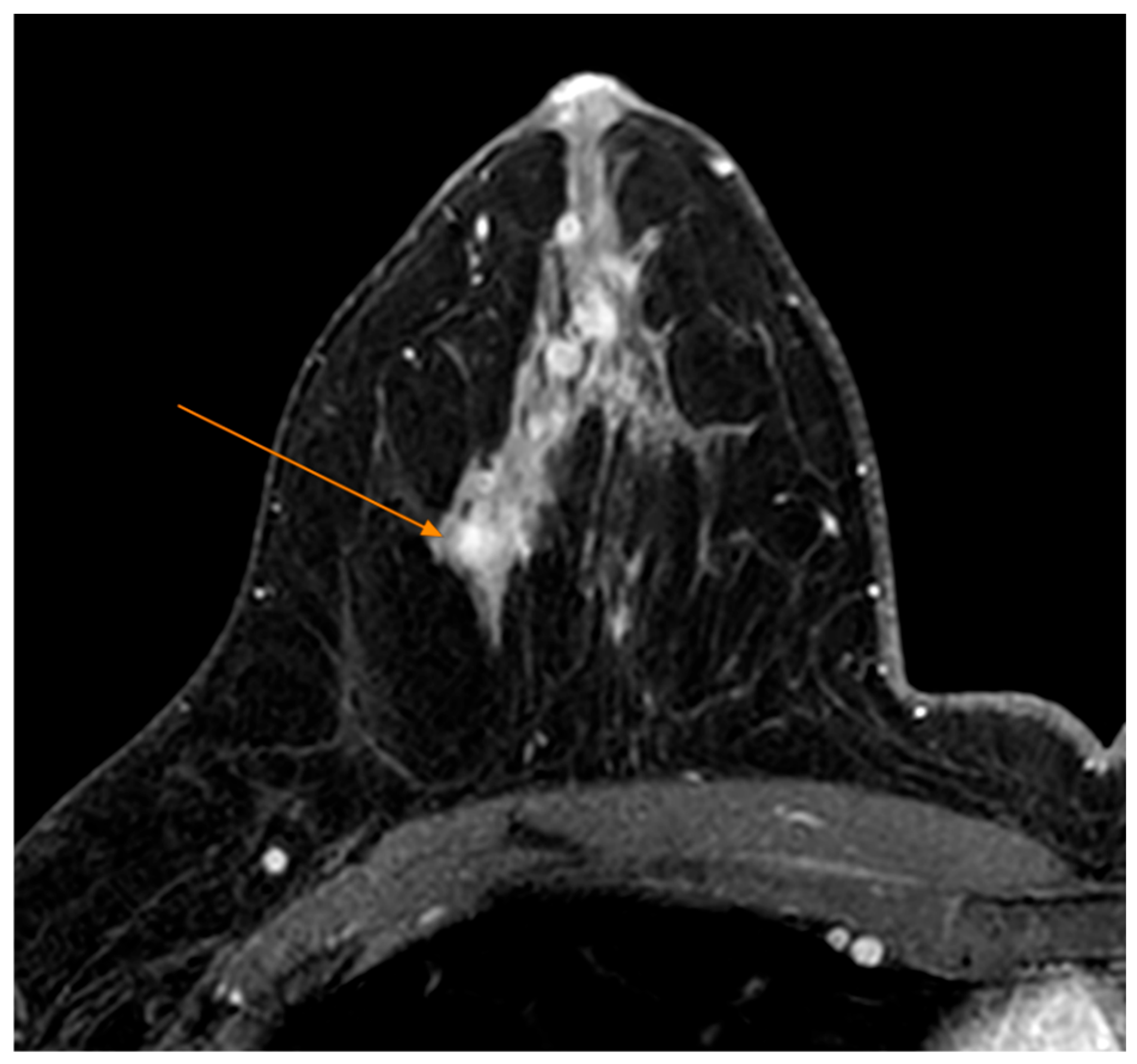 Therapeutic Patterns and Surgical Decision-Making in Breast Cancer: A ...