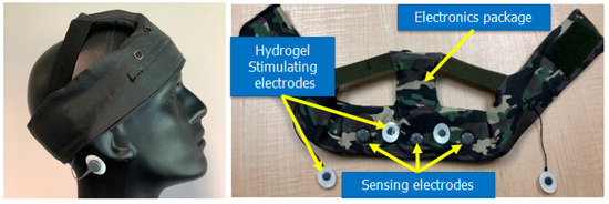 Wearable Neurotechnology for the Treatment of Insomnia: The Study ...