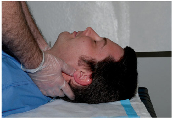 Comprehensive Airway Management of Patients with Maxillofacial Trauma