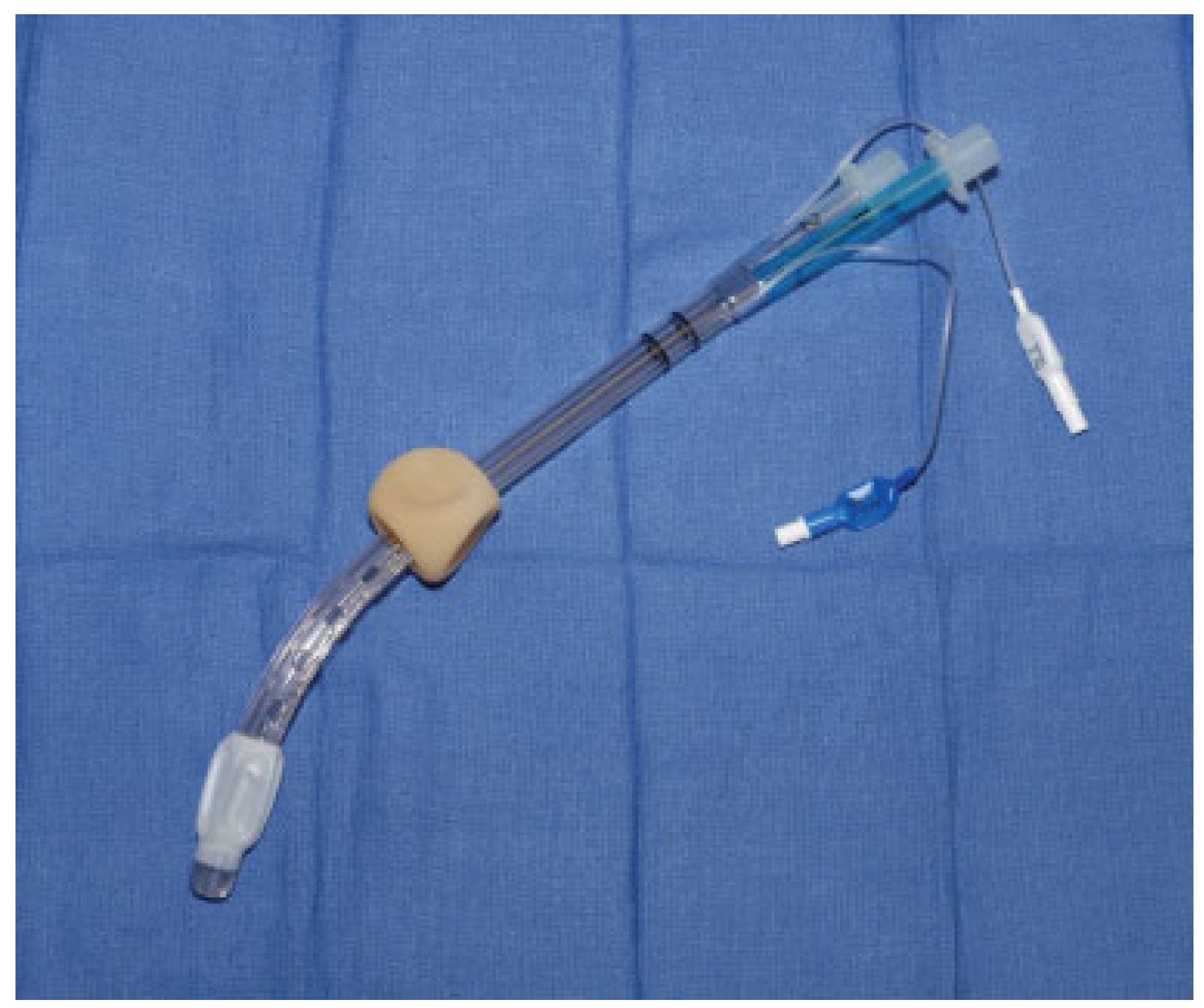 Comprehensive Airway Management of Patients with Maxillofacial Trauma
