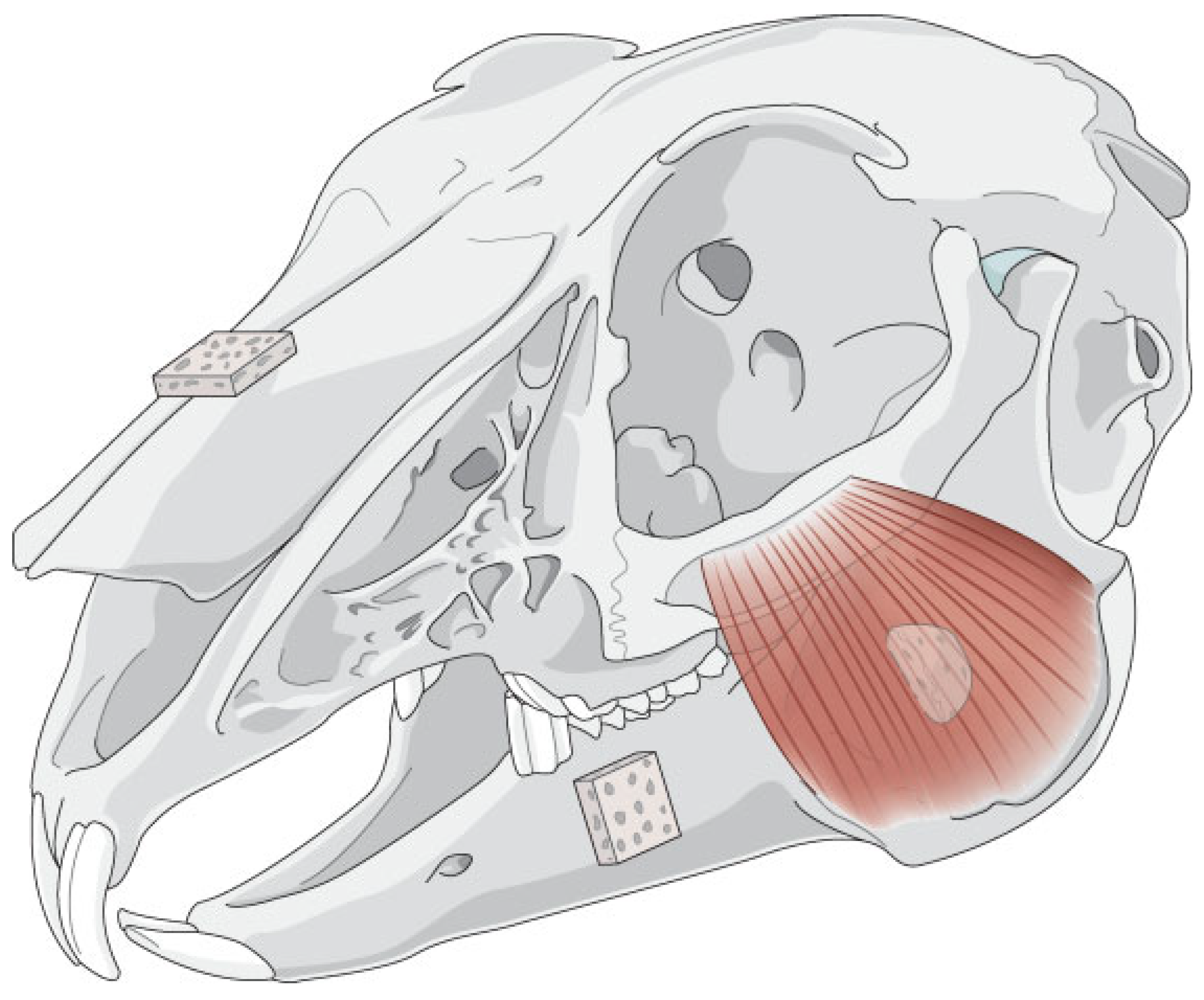 Craniofacial Bone Grafting: Wolff's Law Revisited