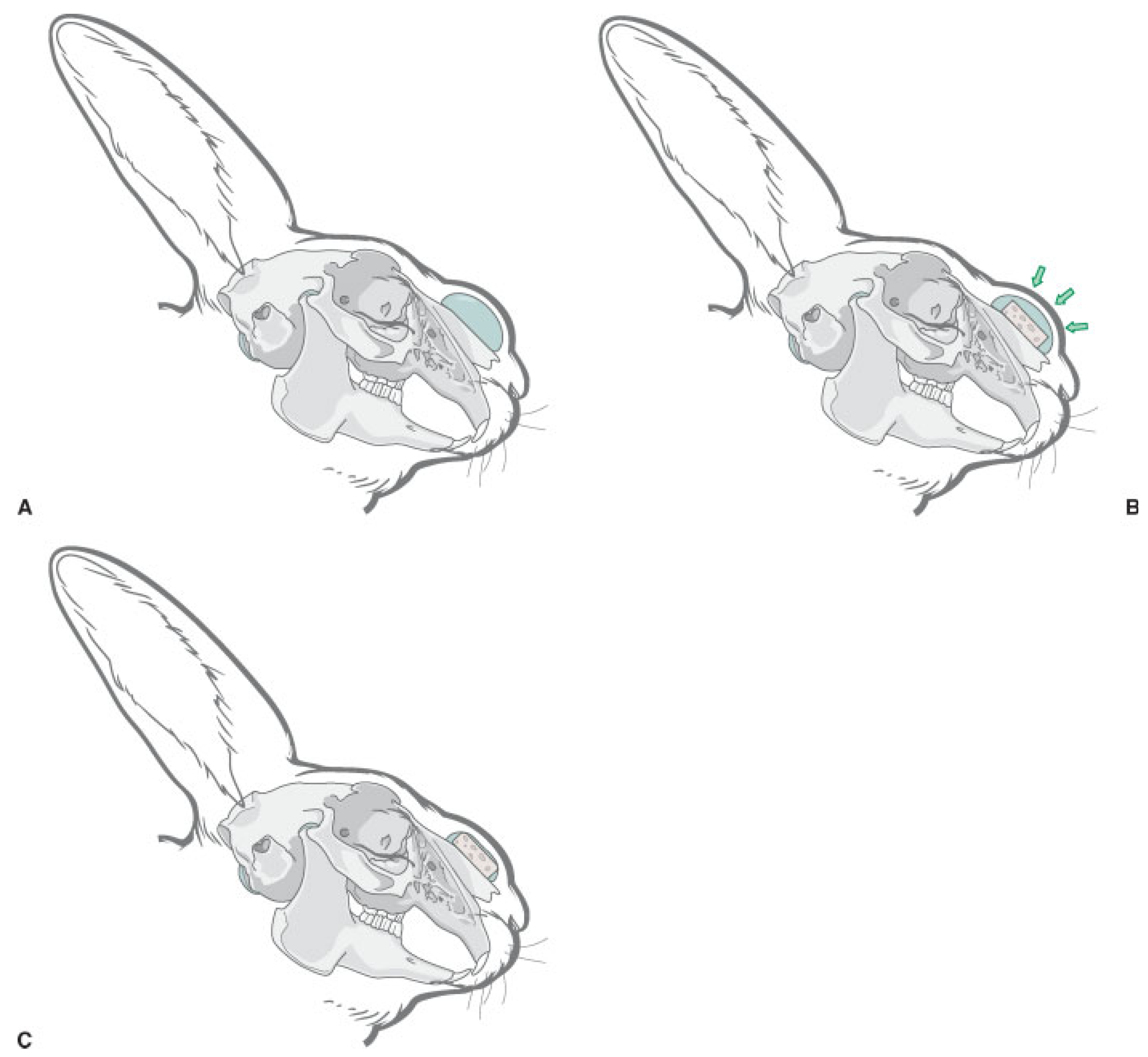 Craniofacial Bone Grafting: Wolff's Law Revisited