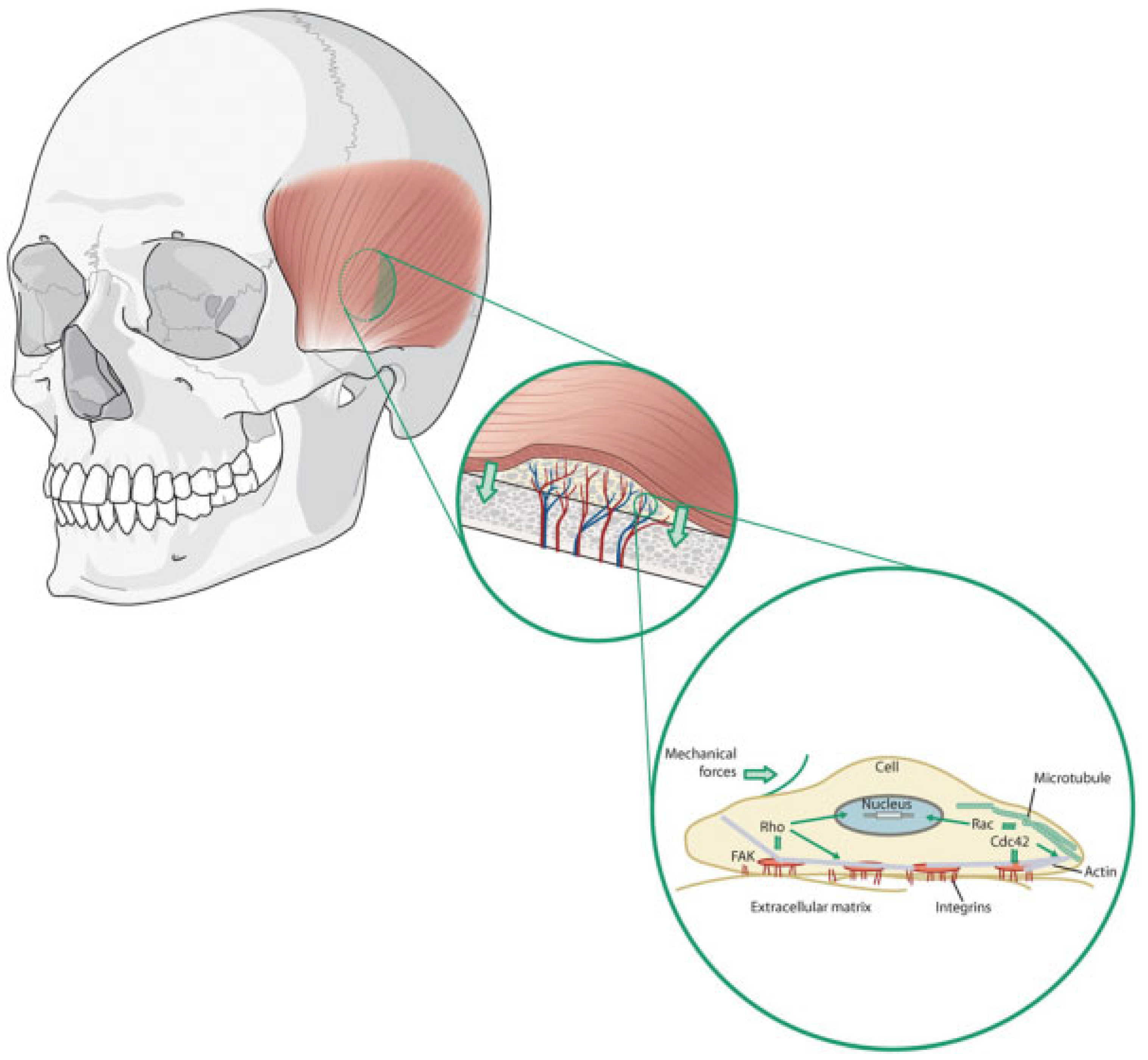 Craniofacial Bone Grafting: Wolff's Law Revisited