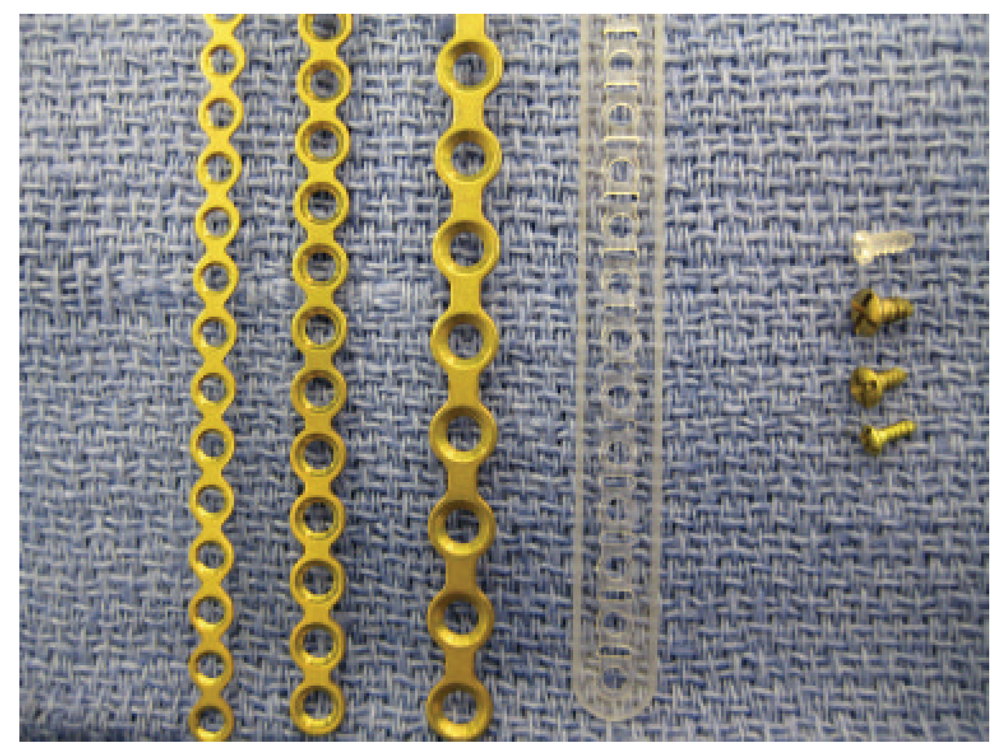 Choice of Internal Rigid Fixation Materials in the Treatment of Facial ...