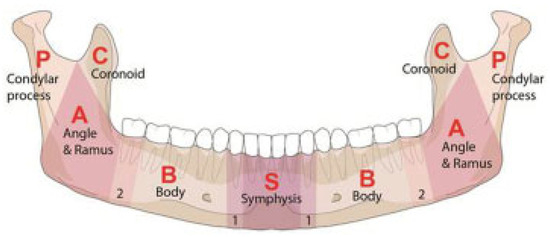 The Comprehensive AOCMF Classification System: Mandible Fractures—Level ...